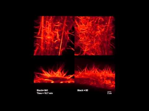 WEBINAR: Light Sheet Microscopy for Tissue Clearing Applications & 3D ...