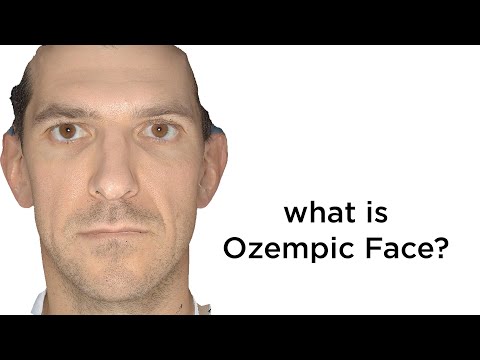 This Is What Ozempic Face Looks Like | Facial Wasting After Rapid Weight Loss | Mounjaro | Wegovy