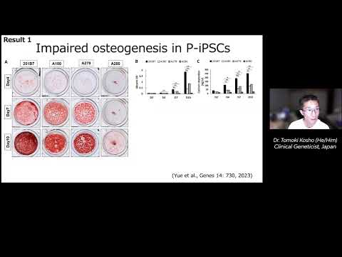 2023 iPSC in musculocontractural EDS - Dr. Tomoki Kosho