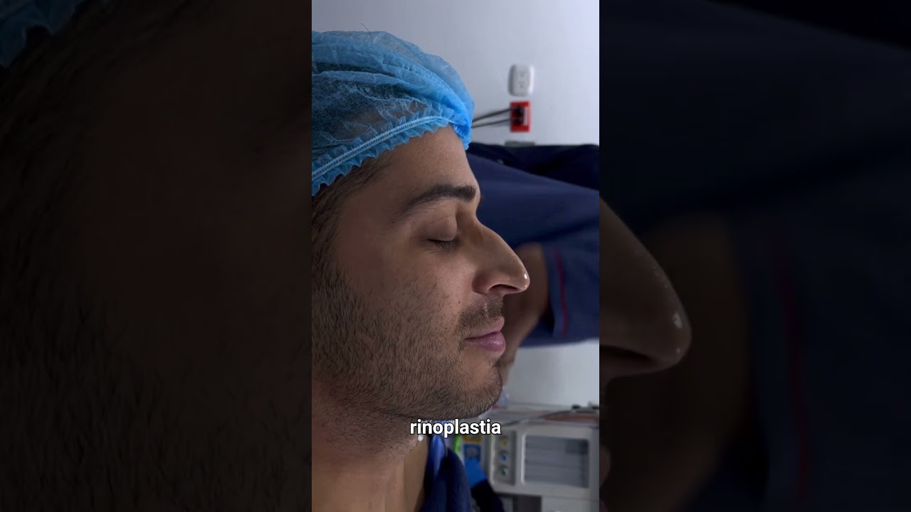 Resultados de rinoplastia minutos después de cirugía   #cirugiadenariz #antesydespues