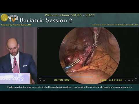 Gastro-gastric fistulae in proximity to the gastrojejunostomy: preserving the pouch and sparing ...