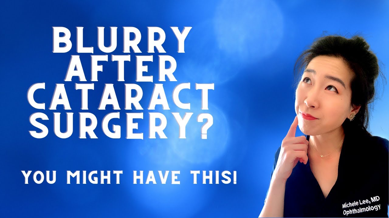 The Most Common Complication From Cataract Surgery! | Posterior Capsular Opacity & How To Treat It