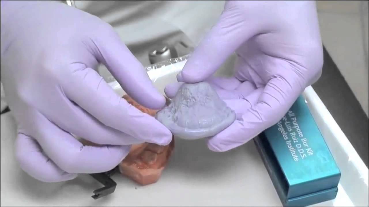 Direct Composite for Rehabilitation - Presented by Jose-Luis Ruiz, DDS