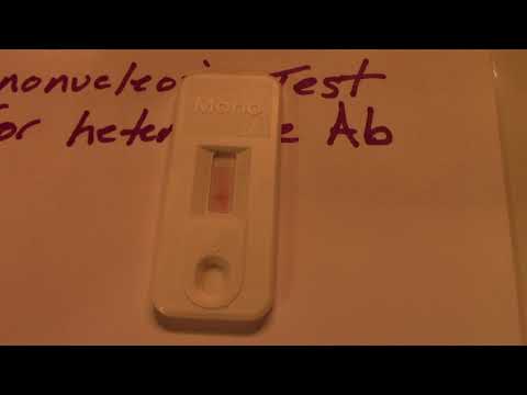 EIA (ELISA) - Antibody Detection