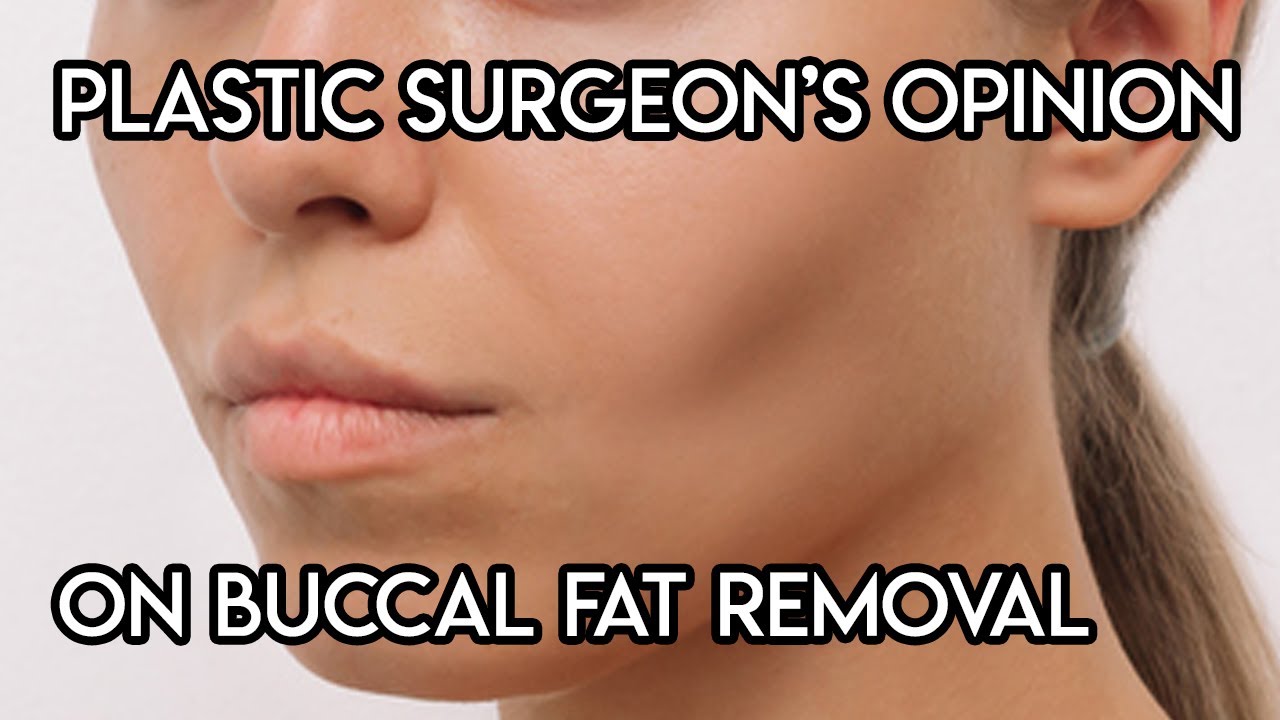 Plastic Surgeon's Opinion on Buccal Fat Removal