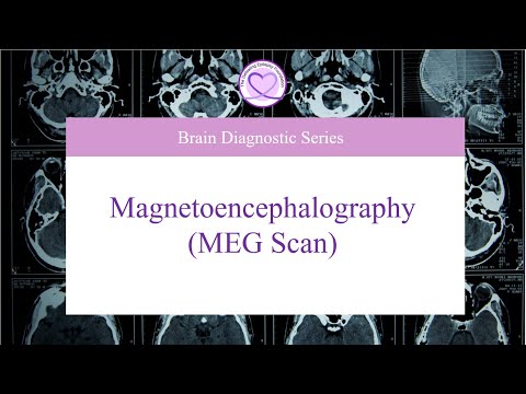 What is a MEG Scan?