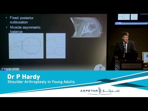 Shoulder Arthroplasty in Young Adults by Dr P Hardy