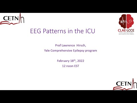 EEG Patterns in the ICU by Prof Lawrence Hirsch