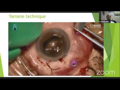 AIOC2021-GP43-Topic-Dr.MANMATH KUMAR DAS-Tools in our armamentarium