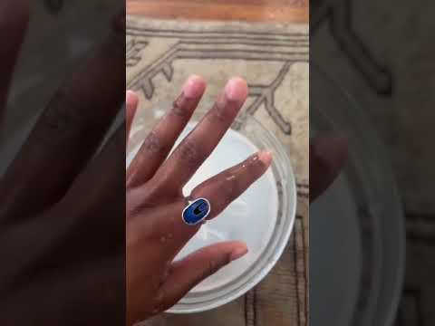 Hospital Ring Hack! #shorts