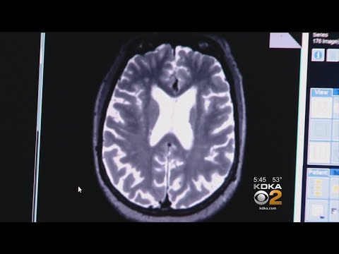 UPMC Looking For Participants For Depression, Dementia Study