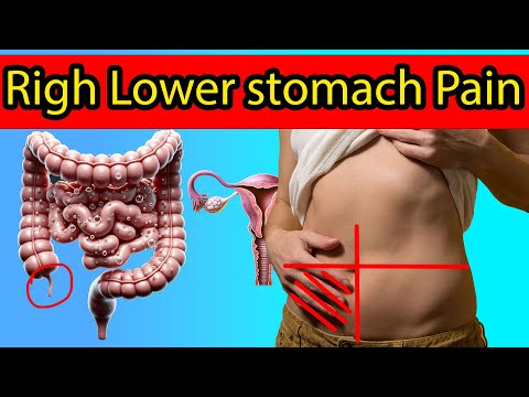 Right Lower Abdominal Pain, 7 Causes You Need to Know!