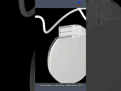 implantable cardioverter-defibrillator (ICD) ( #heart #arrhythmia ).