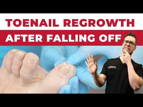Why Are My Toenails Falling Off? 7 Shocking Causes