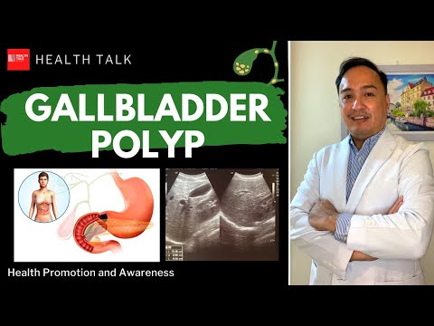 What happens if you have polyps in your gallbladder? Symptoms, Causes, Treatment & Prevention