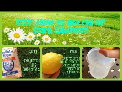 DIY: How to get rid of Dark Elbows?