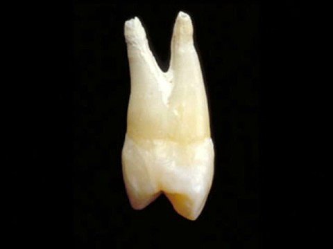 maxillary teeth