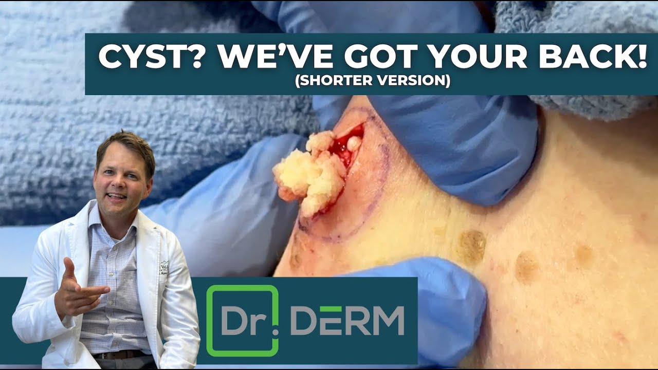 Videos - Utah Valley Dermatology