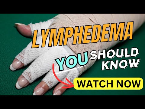 What is Lymphedema: 10 Fascinating Facts | Lymphedema Awareness