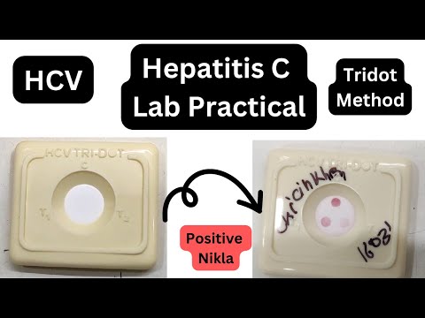 HCV Test Kit - HCV Rapid Test Kit Latest Price, Manufacturers & Suppliers