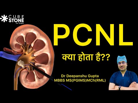 Kidney Stone PCNL | PCNL क्या होता है?| Kidney Stone Treatment | Percutaneous Nephrolithotomy