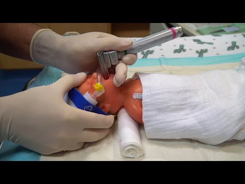 Poractant Alfa Injection - Curosurf Latest Price, Manufacturers & Suppliers