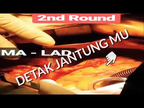 JAGA DETAK JANTUNGMU JANGAN SAMPAI BERHENTI