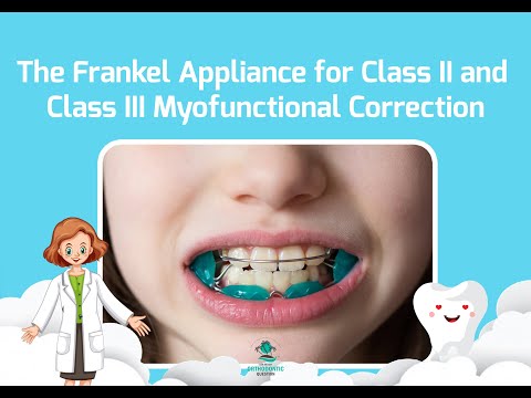 The Frankel Appliance for Class II and Class III Bites