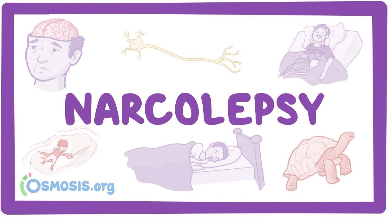 Narcolepsy (NORD) - causes, symptoms, diagnosis, treatment, pathology