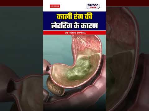 काली रंग की लेटरिंग (Black Stool ) के कारण! #rectal #rectalbleeding #rectalcancer @ThyDocHealth