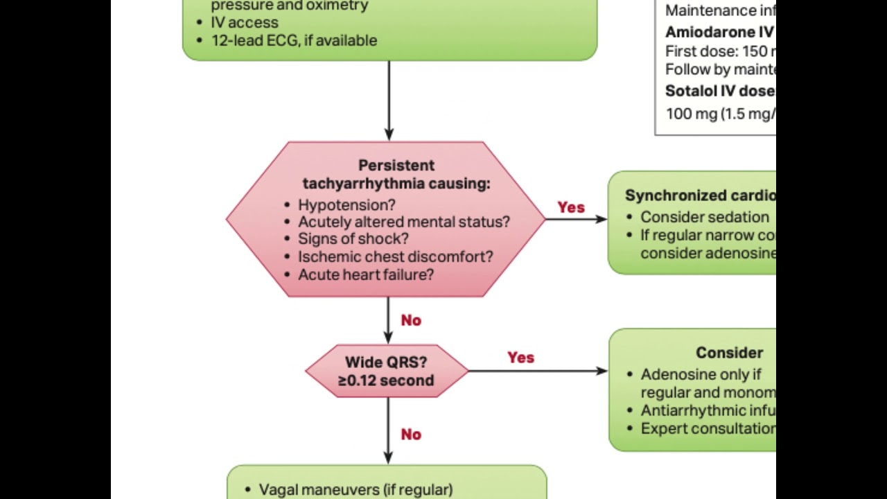 Tachycardia Management - ACLS 2020