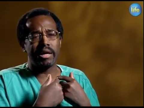 Dr. Ben Carson Separates Sinuses of Conjoined Twins