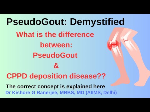 PseudoGout: Why all CPPD-deposition disease is NOT PseudoGout? #medicos #PseudoGout