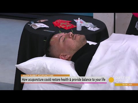 How acupuncture could restore health & provide balance to your life