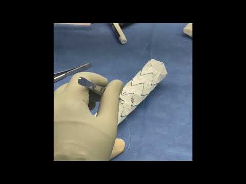 Physician-Modified Endografts, Creating Fenestrations