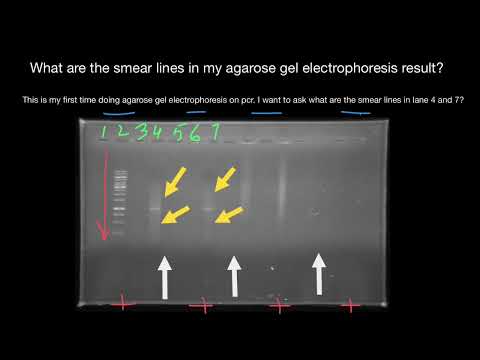 How to avoid smear in your Gel Electrophoresis