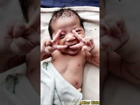 Wonderful Reaction of Adorable Newborn Baby @AfterBirth First Cry
