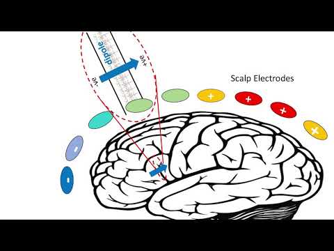 EEG - Electrical 'Brainwaves'