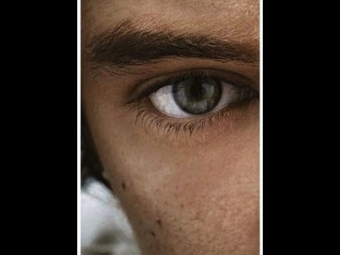 Hollow eyes
