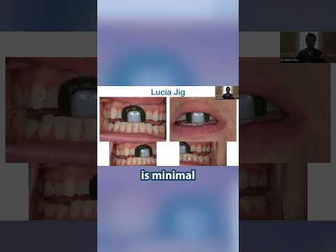 Dentists, here's a Lucia Jig tip!