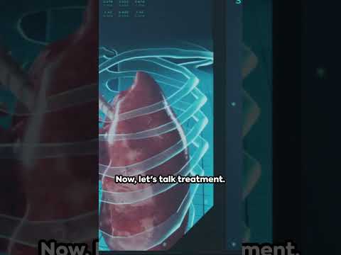 A Minute of Knowledge Congestive Heart Failure #heartdisease #science