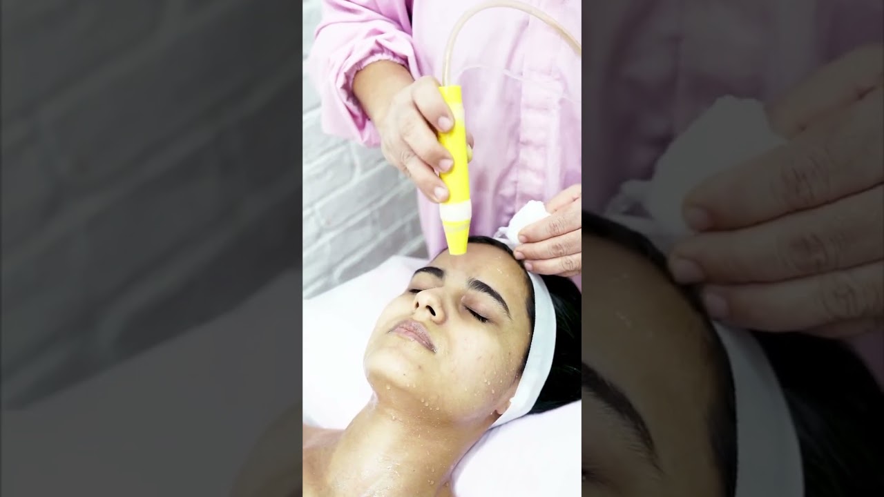 AgeLess HIFU FacialTM
