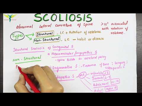 Scoliosis - Types | Medical Symptomatology