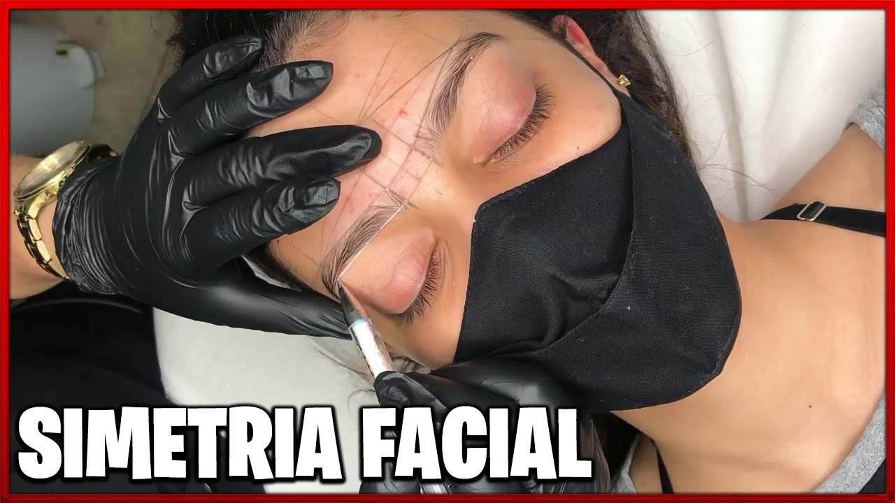 MARCAÇÃO COM PAQUIMETRO PASSO A PASSO (SIMETRIA FACIAL)