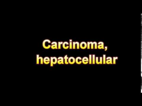 What Is The Definition Of Carcinoma, hepatocellular Medical Dictionary Free Online