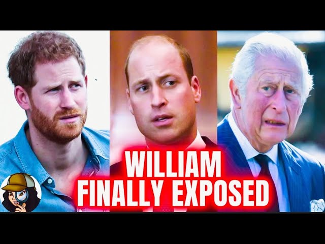 Kate Middleton: "The plot thickens": Prince William bruises on neck ...