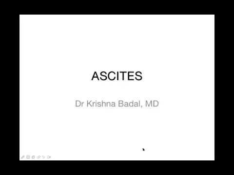 Ascites