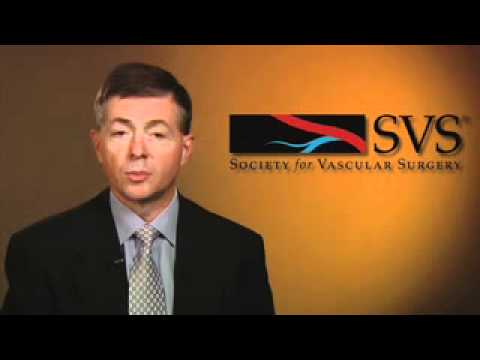 Early History of Vascular Surgery