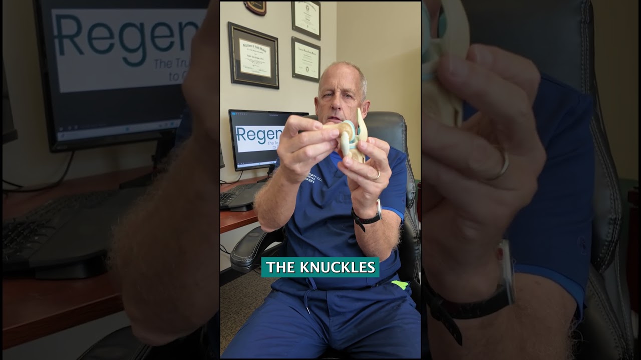 The Truth About Osteoarthritis and Knee Pain