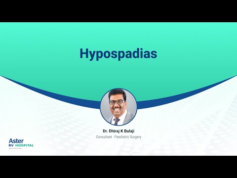 Hypospadias | Dr. Dhiraj K Balaji | Paediatric Surgery | Aster RV